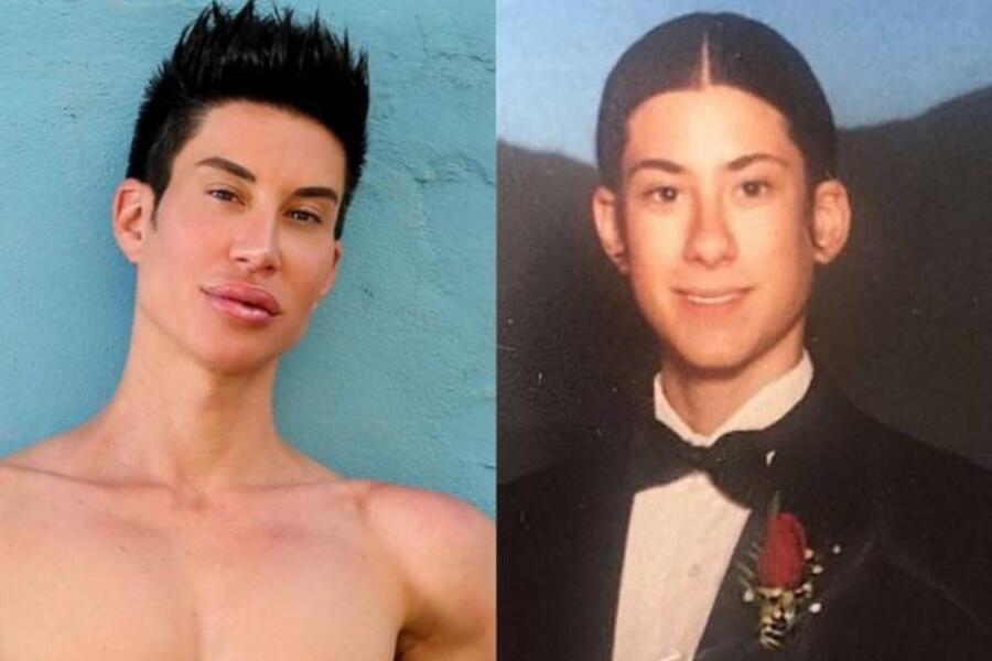 Así luce el 'Ken Humano' al recibir más de mil cirugías